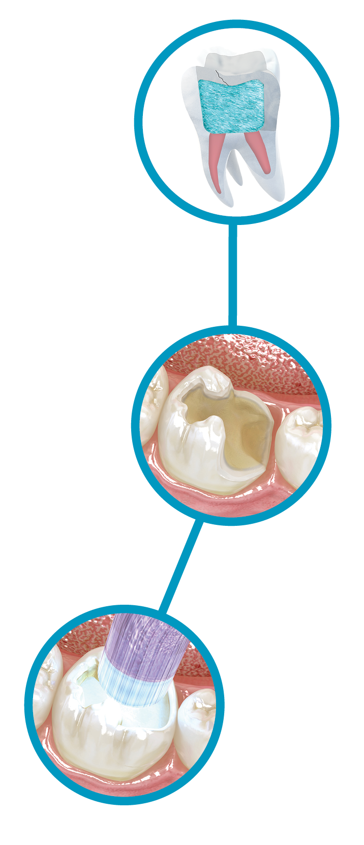 everX Flow - Fiberforstærket flowplast